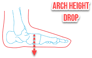 Orthotic Insoles for Plantar Fasciitis - Arch support and Cushioned ...