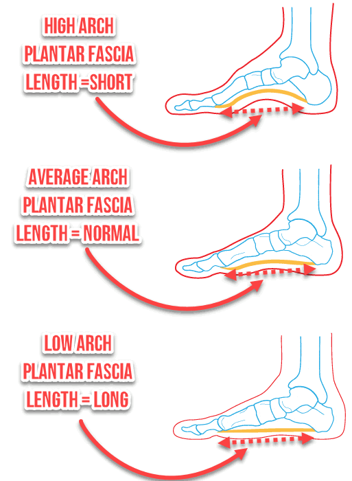 Orthotic Insoles for Plantar Fasciitis - Arch support and Cushioned ...